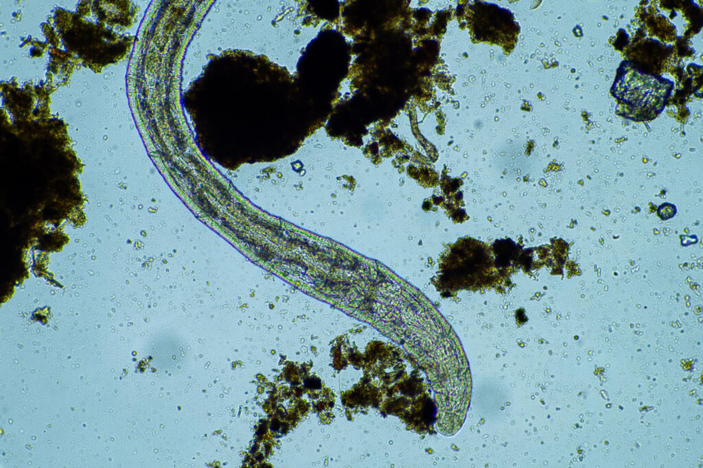 Lėtinė obstrukcinė plaučių liga (LOPL): LOPL: simptomai, priežastys ...